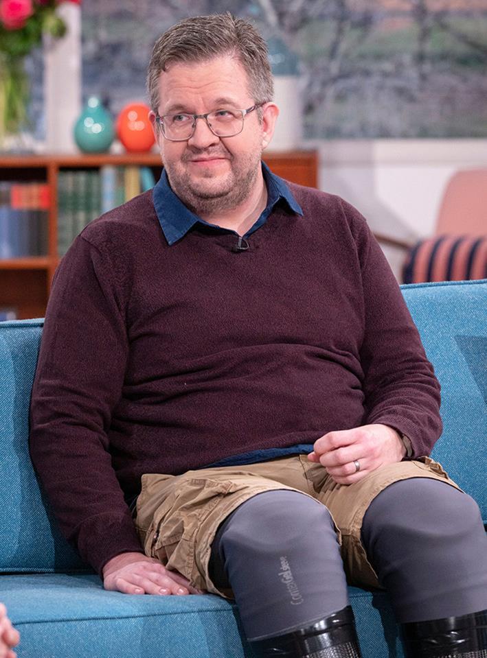 Fraud case of disgraced Cornwall amputee surgeon triggers patient ...